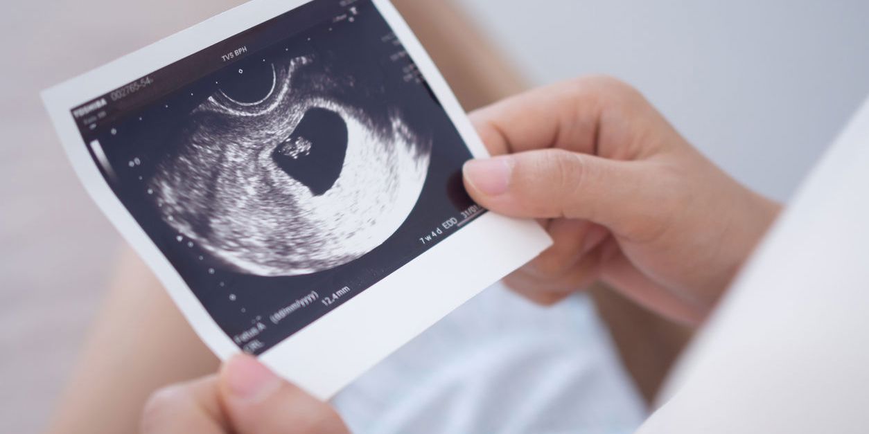 What to Expect at Your First Pregnancy Ultrasound | Your Baby Club