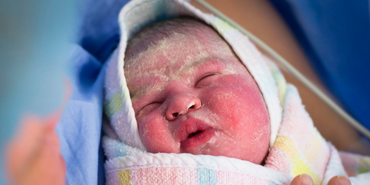Lanugo and Vernix Caseosa: Understanding Baby's First Protective Layers ...